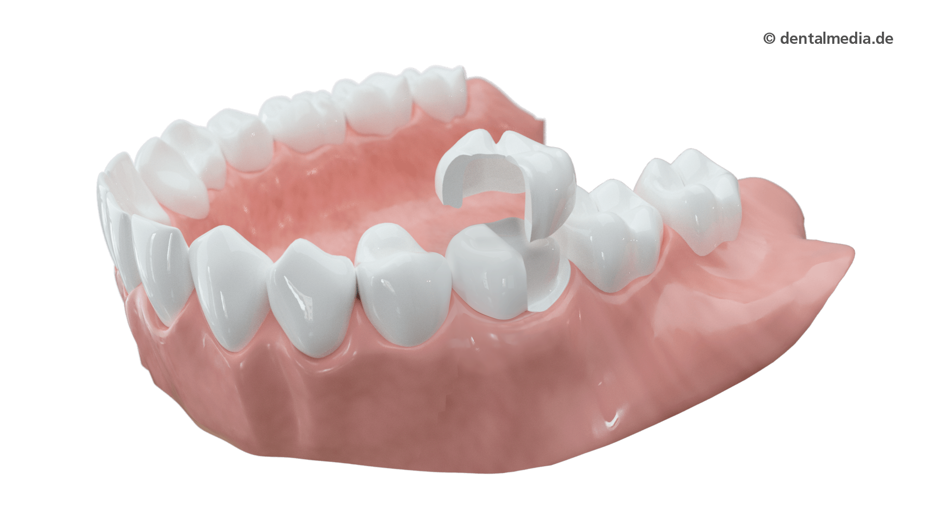 Ästhetik - Zahnarzt Dr. Niekamp - Implantologie Bochum